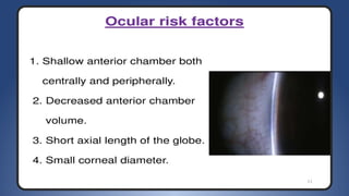 Acute closure angle glaucoma opthalmology.pptx