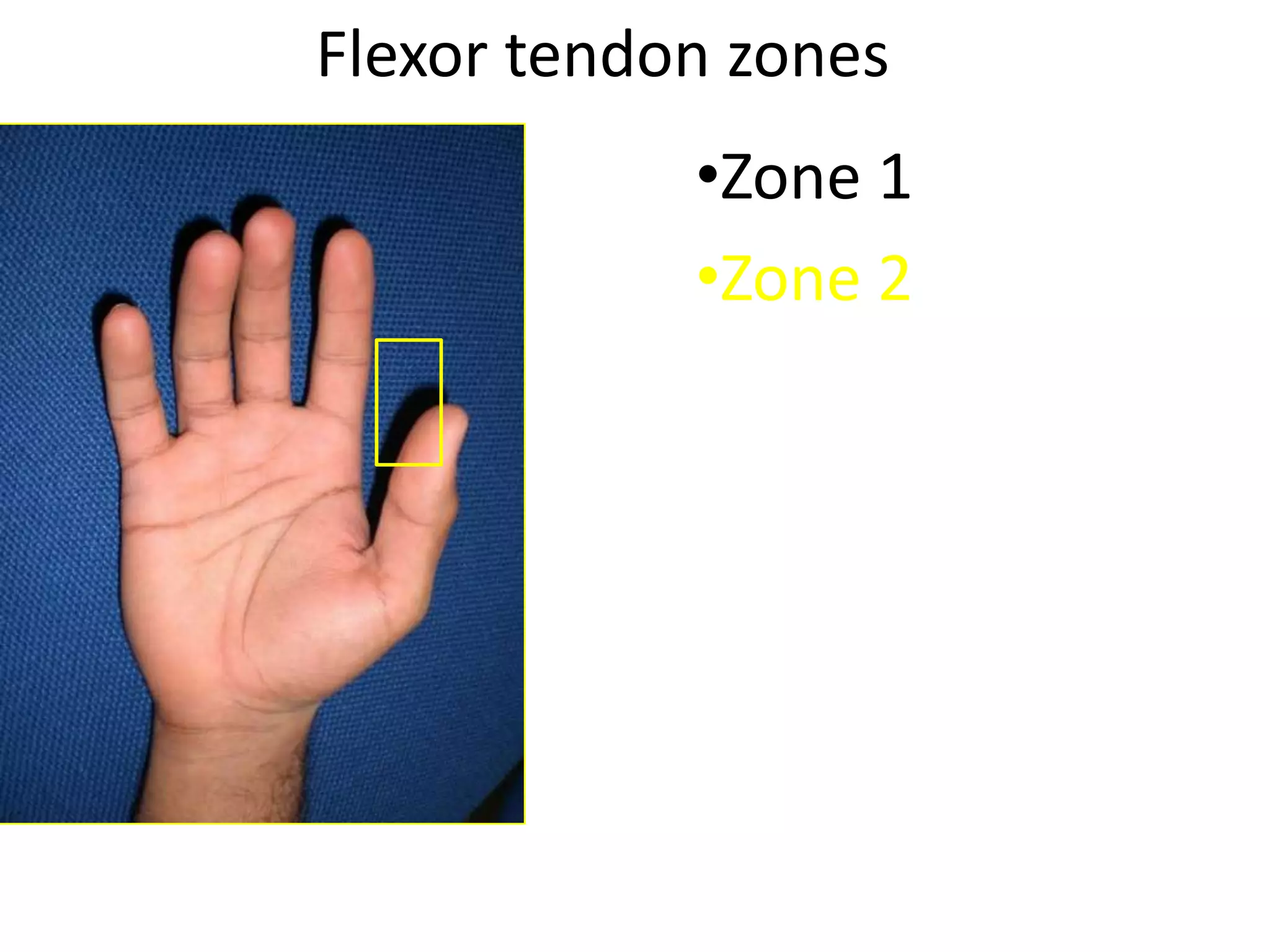 Hand surface anatomy | PPTX