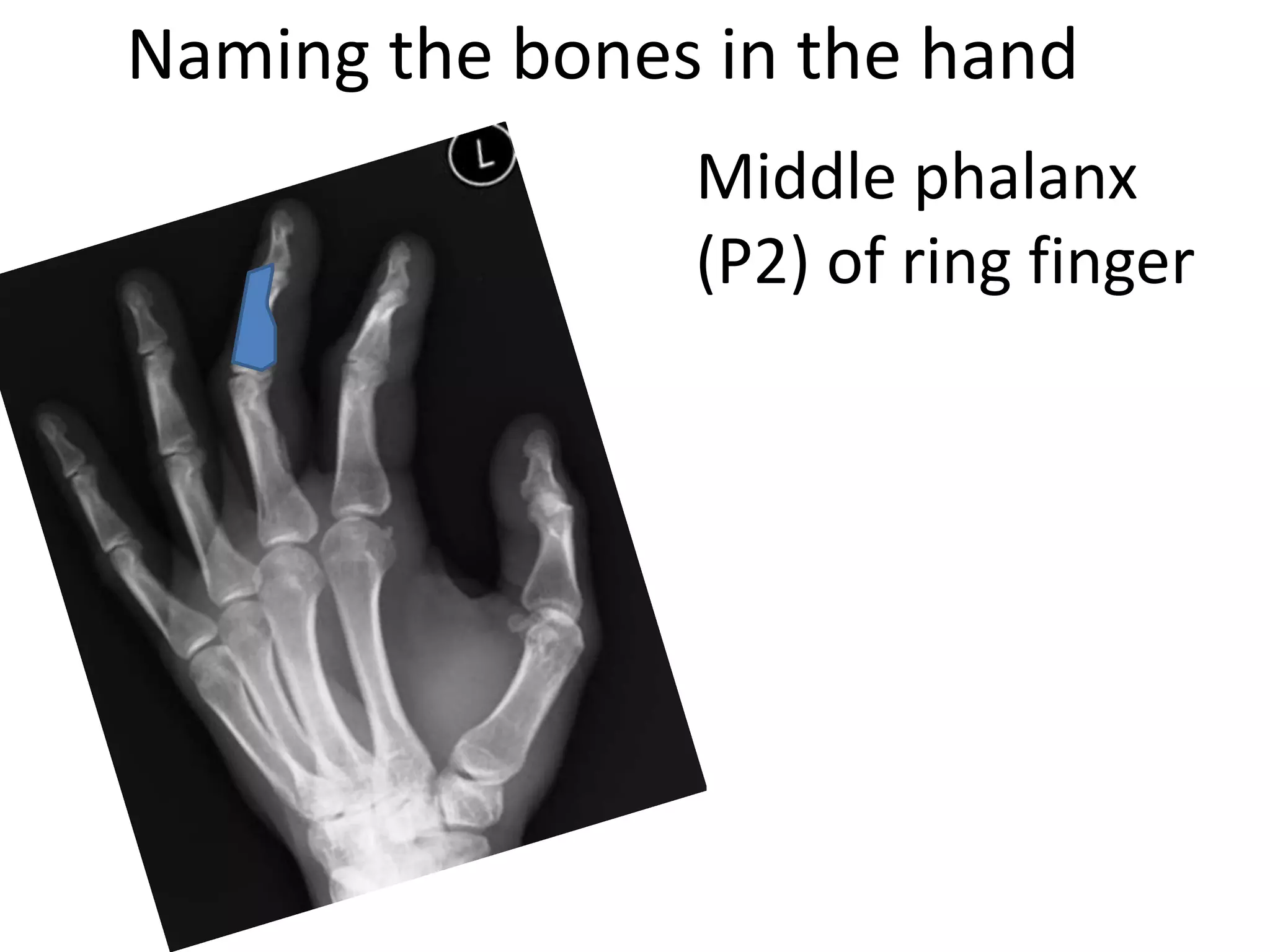 Hand surface anatomy | PPTX