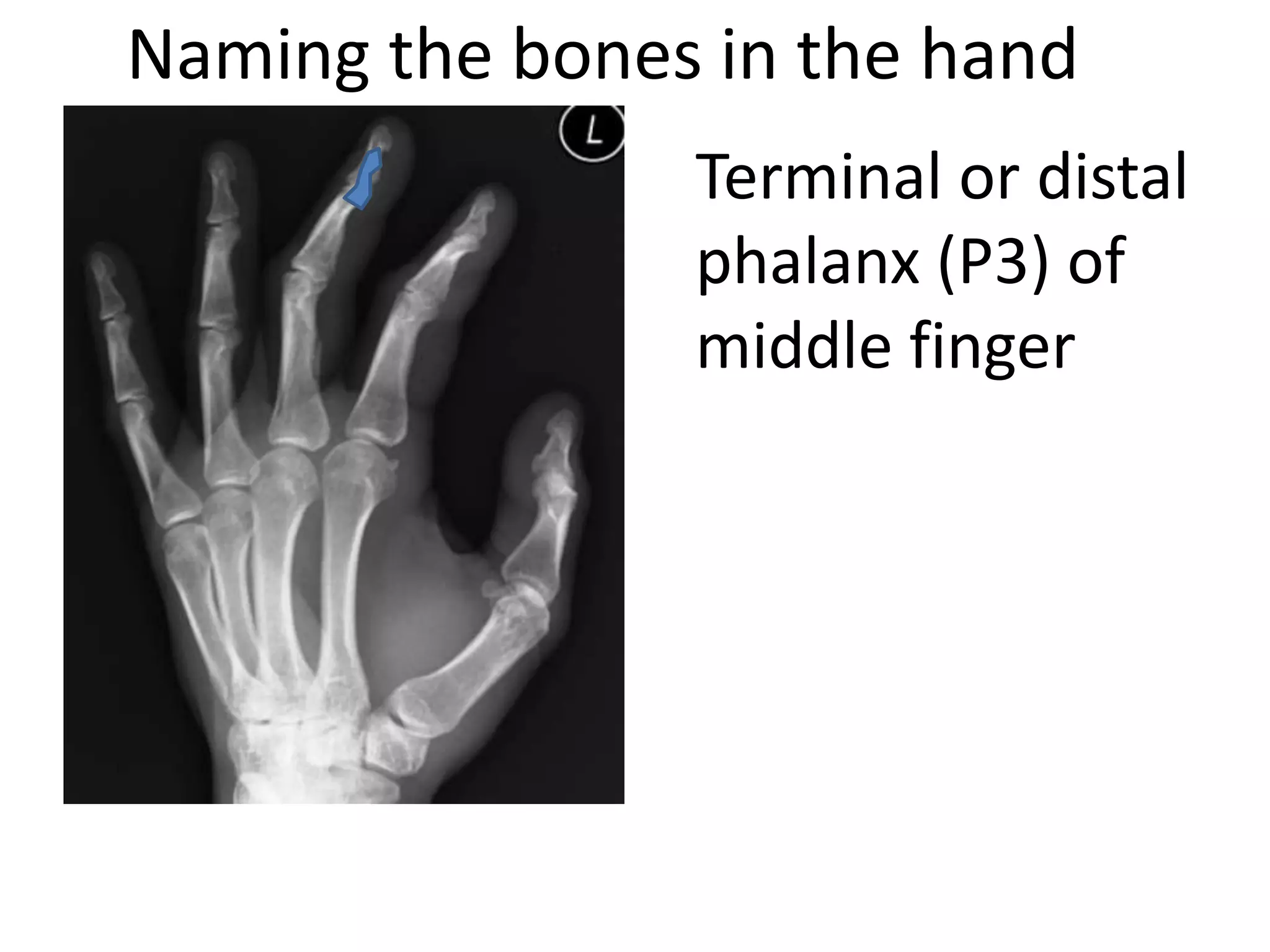 Hand surface anatomy | PPTX | First Aid | Injuries