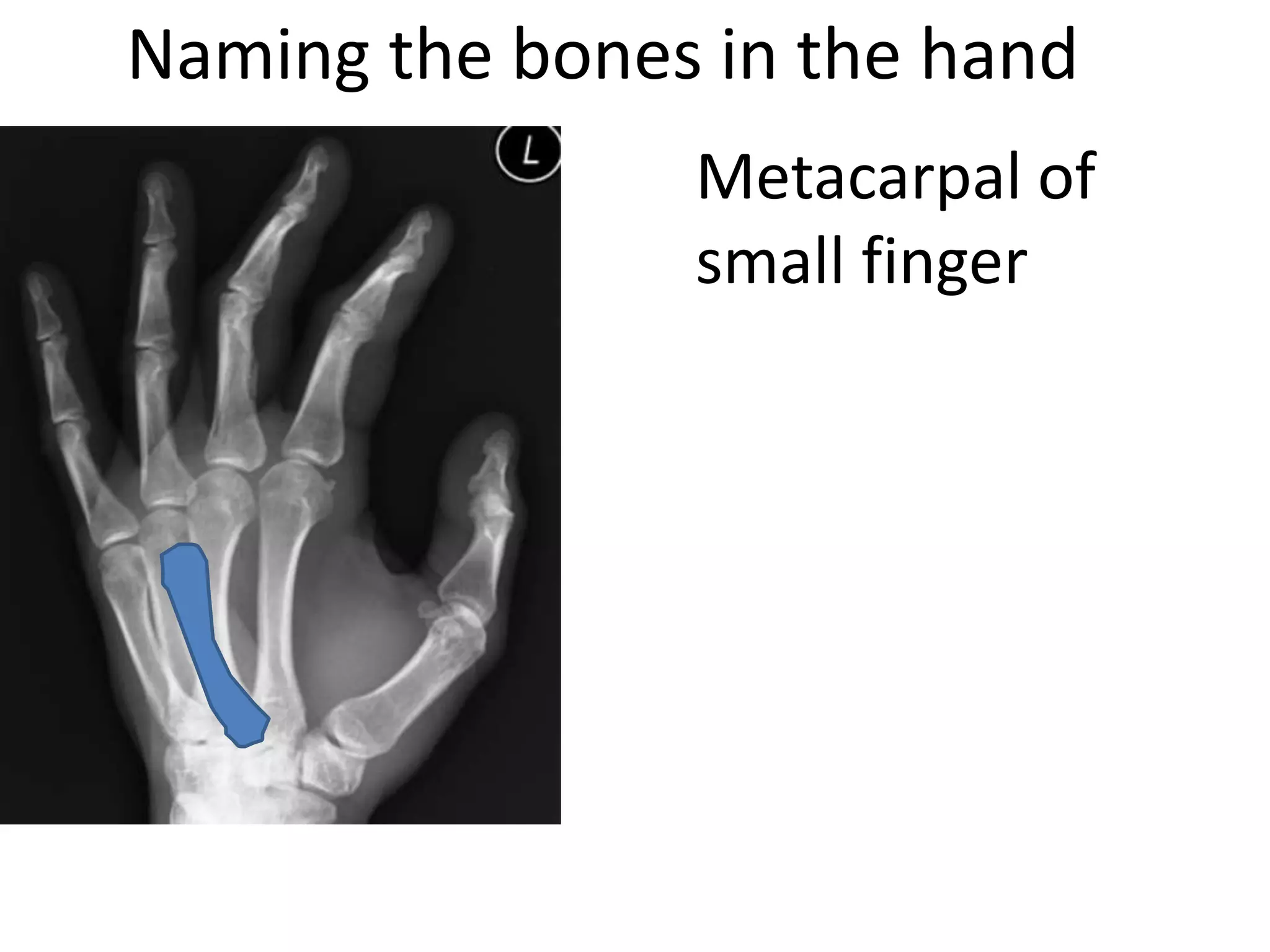 Hand surface anatomy | PPTX