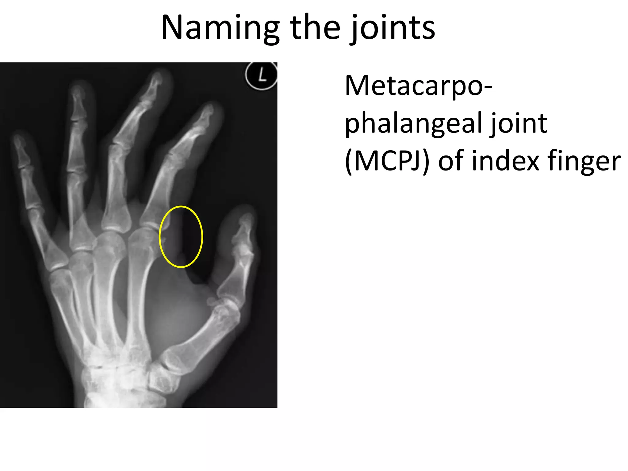 Hand surface anatomy | PPTX | First Aid | Injuries