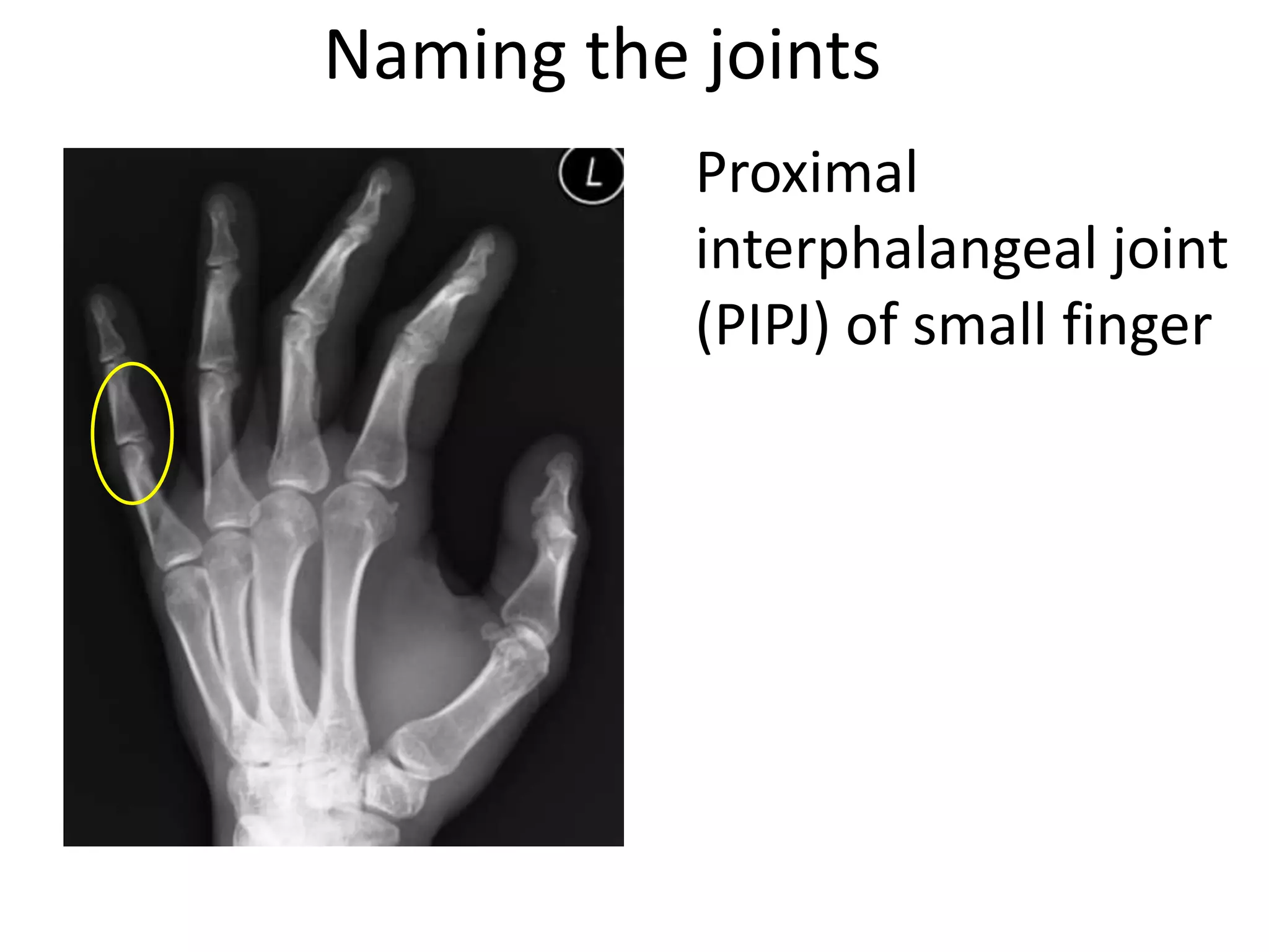 Hand surface anatomy | PPTX