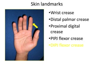 Distal And Proximal Crease In Hand