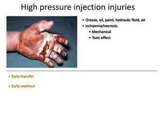 Hand surface anatomy | PPT