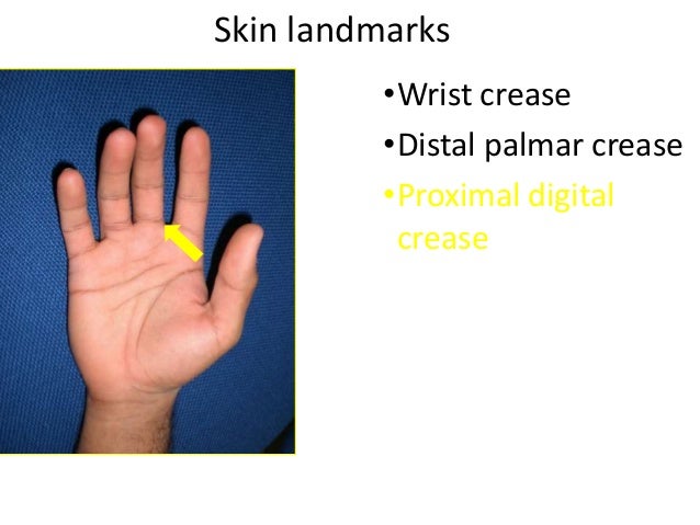 Hand surface anatomy