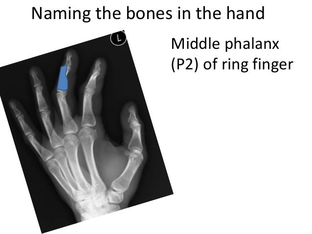 Hand surface anatomy