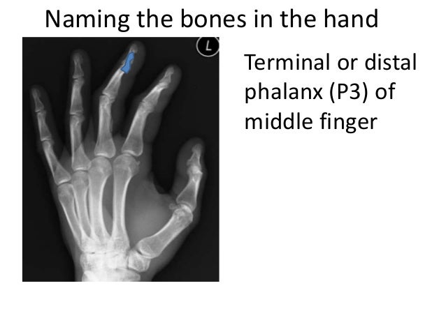 Hand surface anatomy