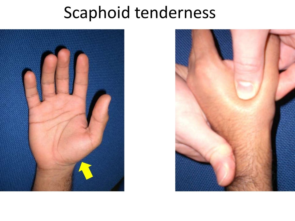 Hand surface anatomy
