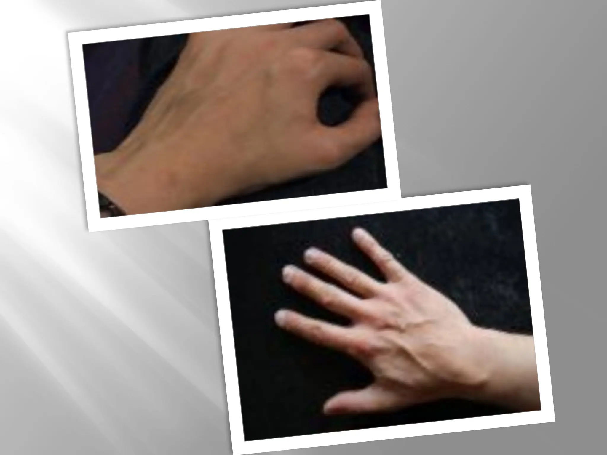 anatomy of the hand and its blood supply.ppt
