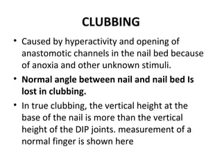 Hand a clue to pediatric diagnosis | PPT