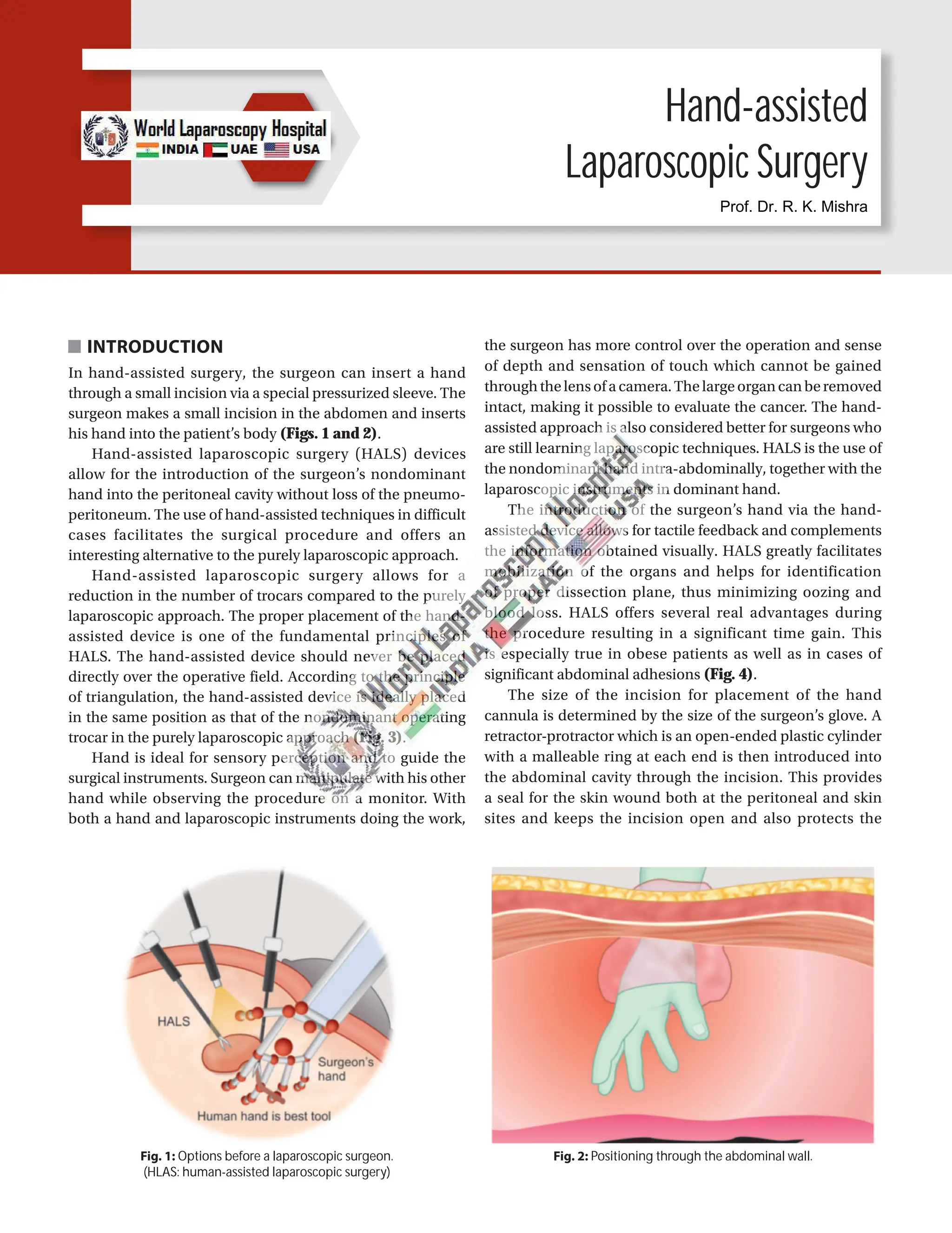 Hand-assisted Laparoscopic Surgery at WLH | PDF