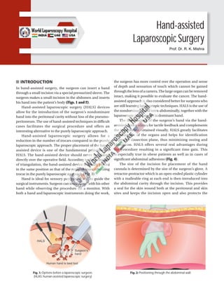 Hand-assisted Laparoscopic Surgery at WLH | PDF