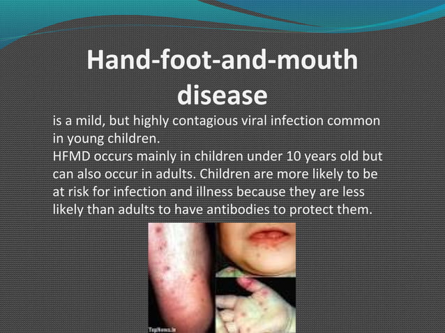 Hand Foot and Mouth Disease (HFMD) - RIS Clinic | PPT