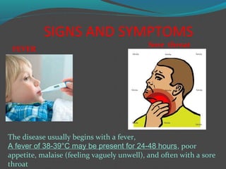 Hand Foot and Mouth Disease (HFMD) - RIS Clinic | PPT