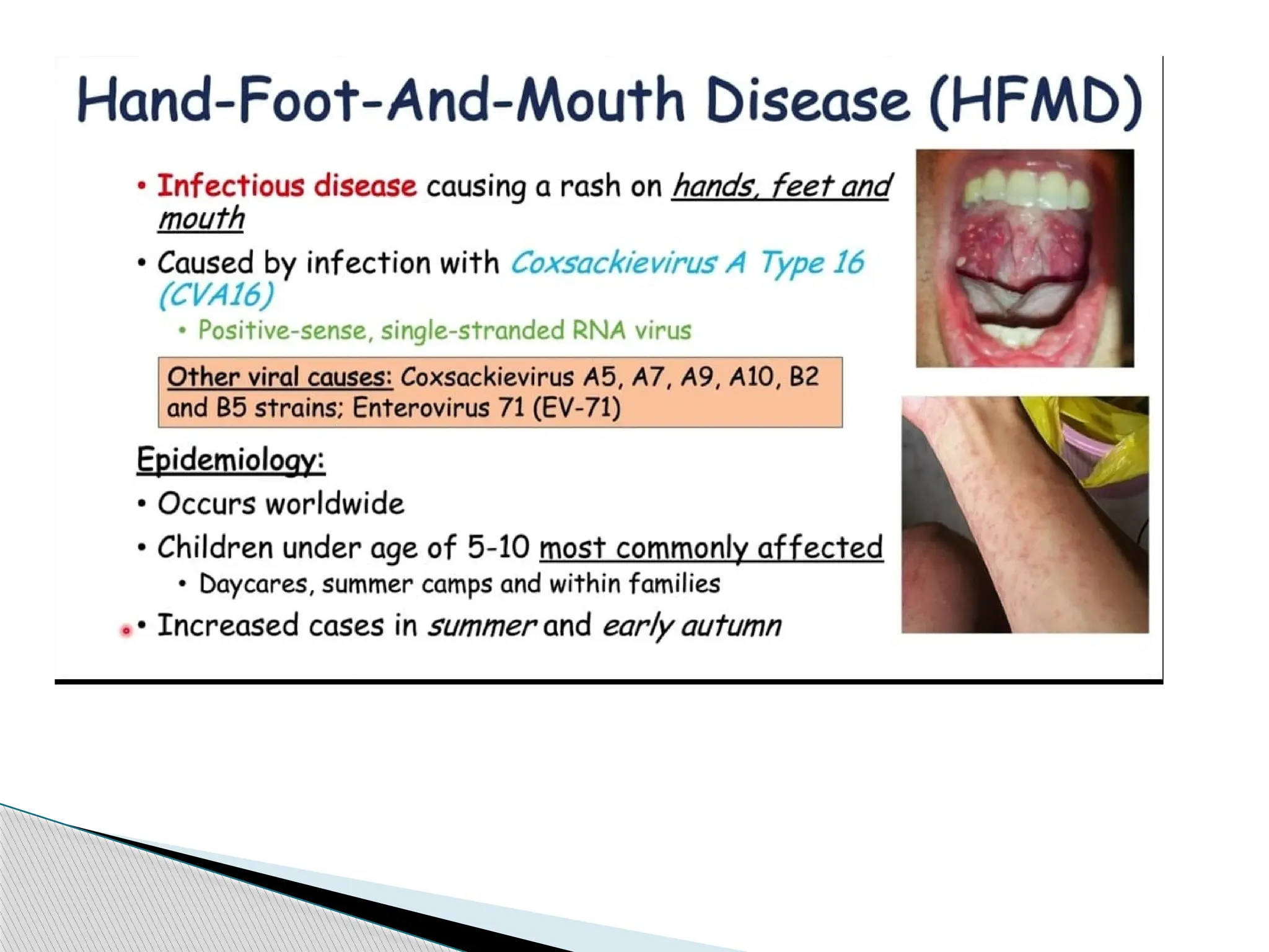 Hand -Foot and Mouth Disease PPT[8380].pptx