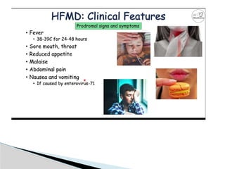 Hand -Foot and Mouth Disease PPT[8380].pptx
