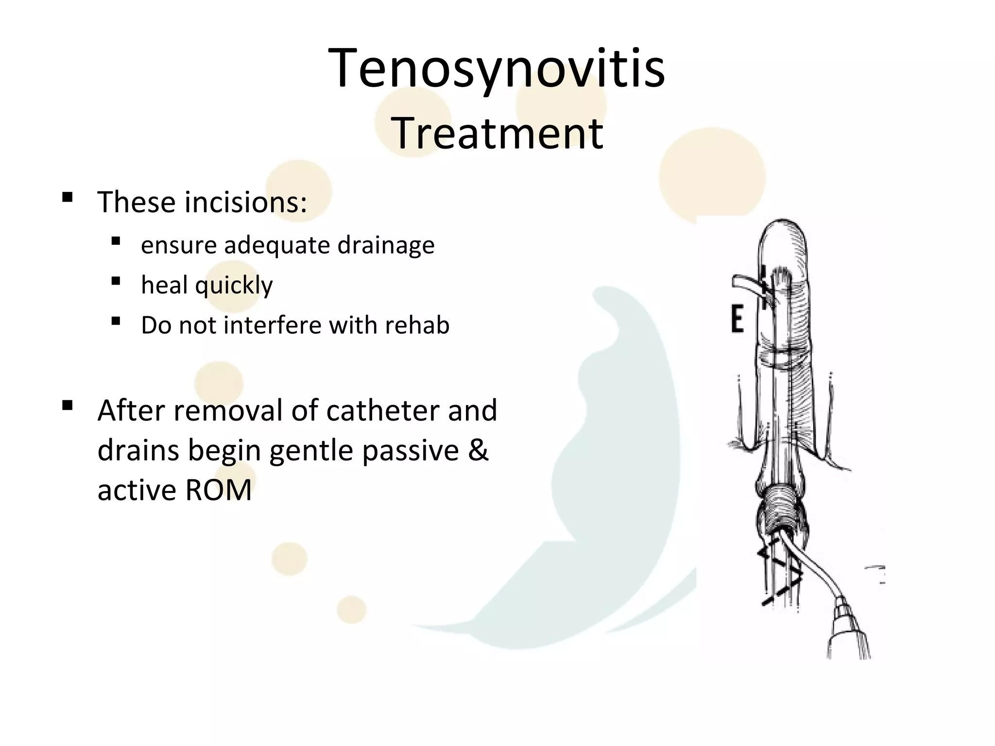 Hand infections | PPT