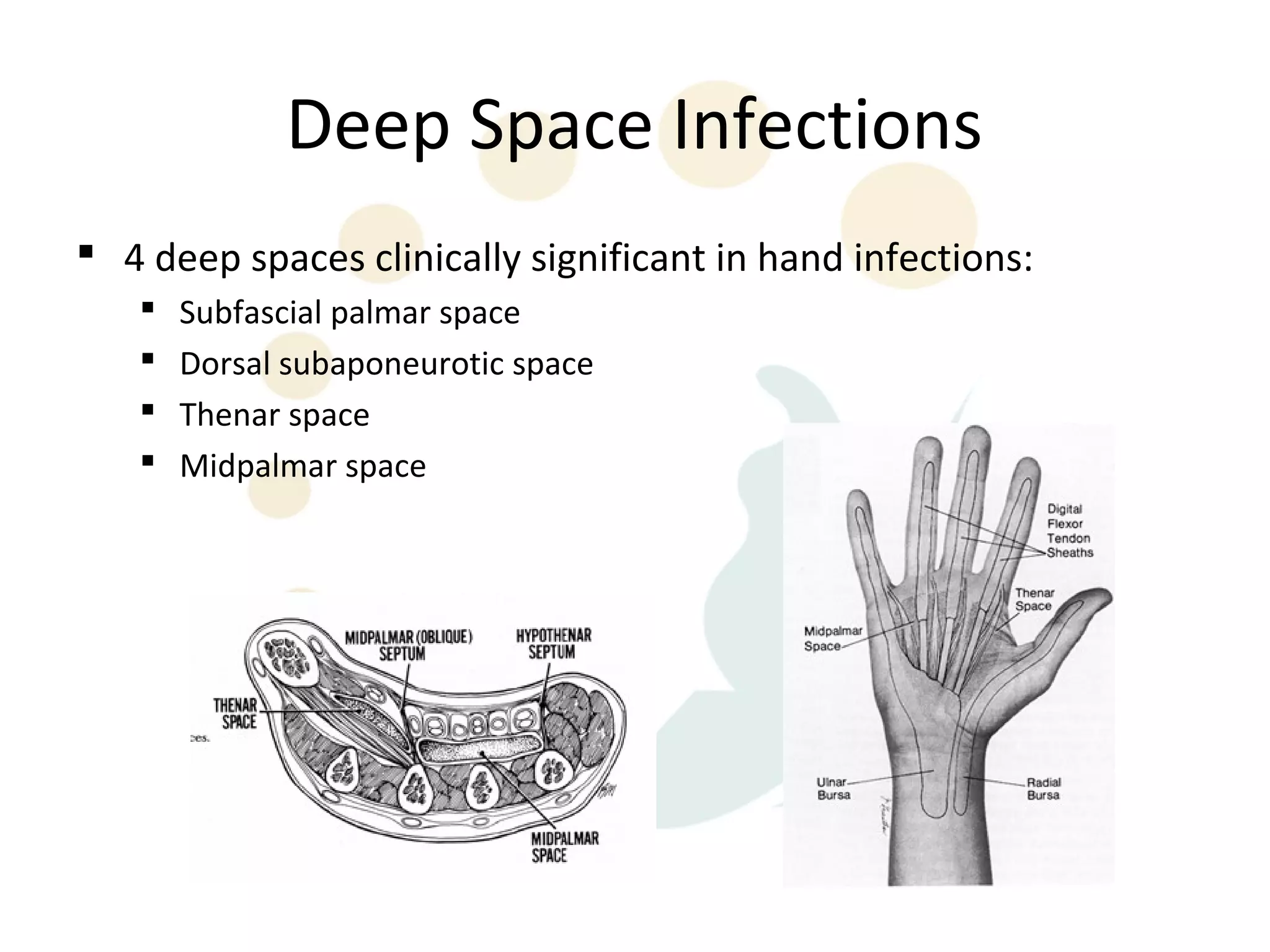 Hand infections | PPT