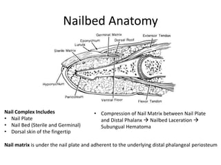 Fingertip injuries | PPT