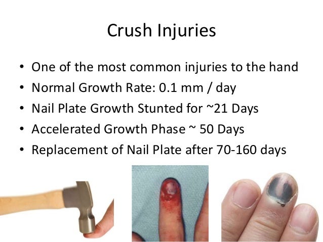 Fingertip injuries