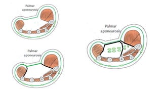 Hand-spaces and arterial arches.pptx