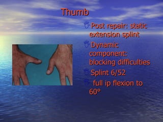 Hand Therapy Rehabilitation – Extensor Tendons | PPT