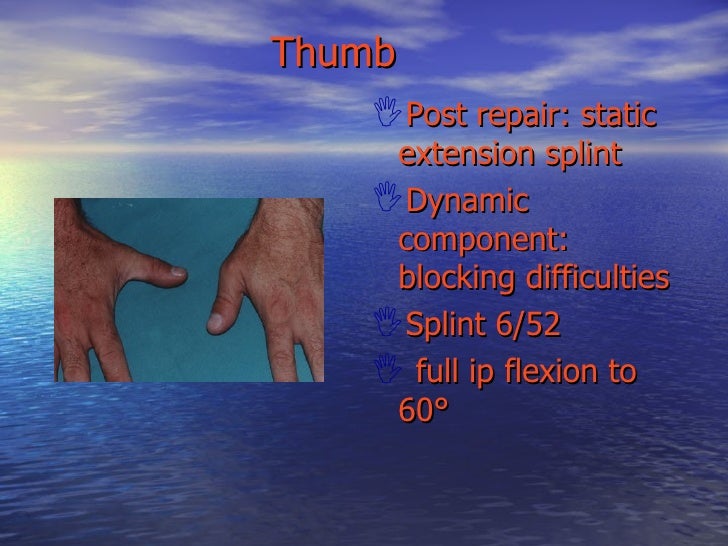 Hand Therapy Rehabilitation – Extensor Tendons