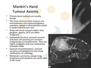 Hand tumours | PPT