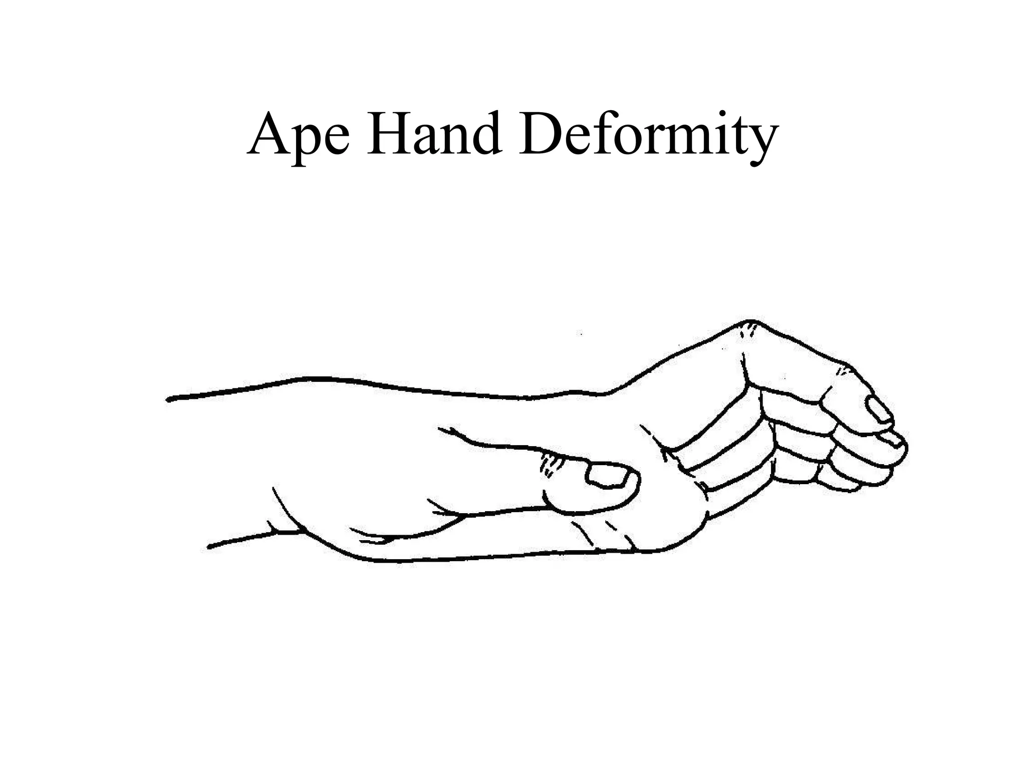 Hand 2009 (2) Questions Included Not To Post | PPT | Death, Injury, or ...
