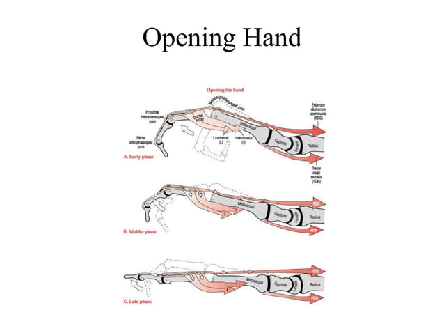 Hand 2009 (2) Questions Included Not To Post | PPT | Death, Injury, or ...