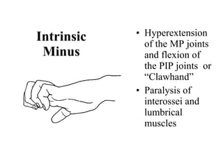 Hand 2009 (2) Questions Included Not To Post | PPT