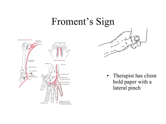 Hand 2009 (2) Questions Included Not To Post