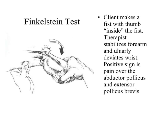 Hand 2009 (2) Questions Included Not To Post