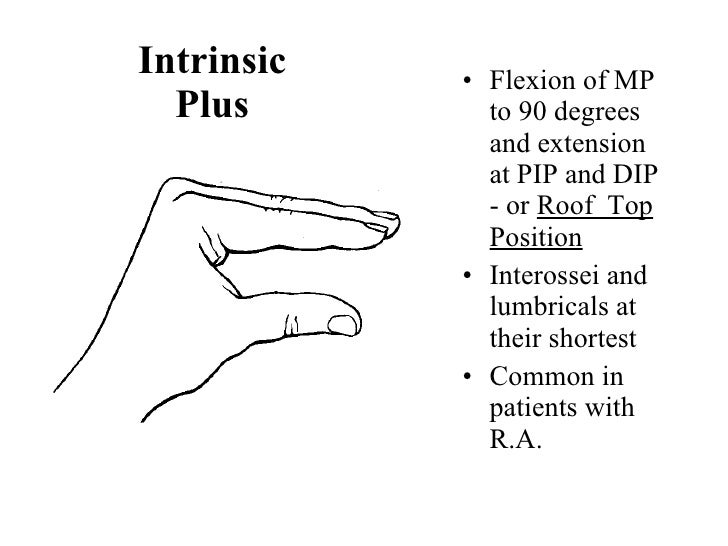 Hand 2009 (2) Questions Included Not To Post