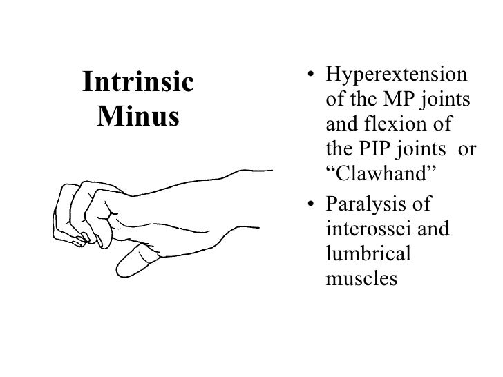 Hand 2009 (2) Questions Included Not To Post