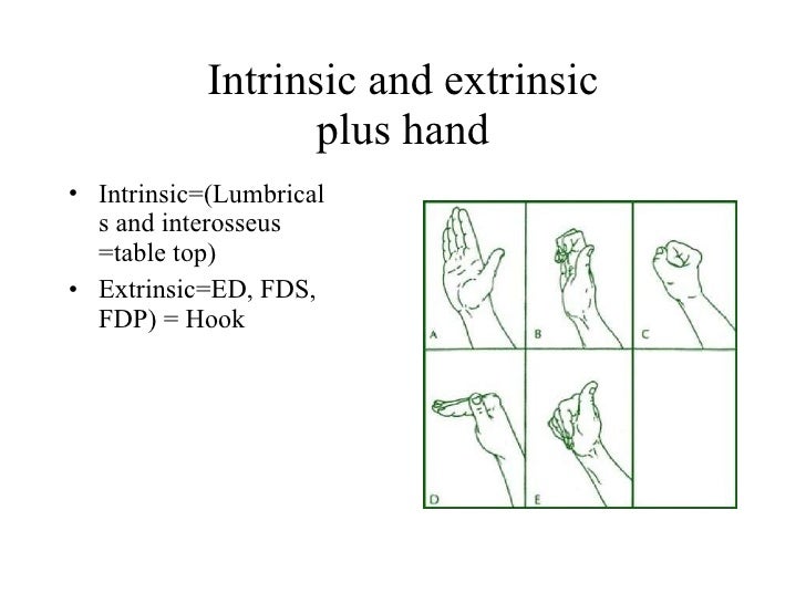 Hand 2009 (2) Questions Included Not To Post