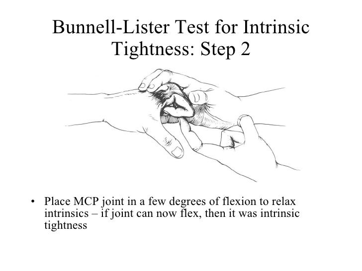 Hand 2009 (2) Questions Included Not To Post