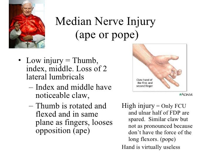 Hand 2009 (2) Questions Included Not To Post