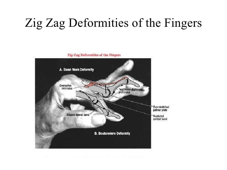 Hand 2009 (2) Questions Included Not To Post