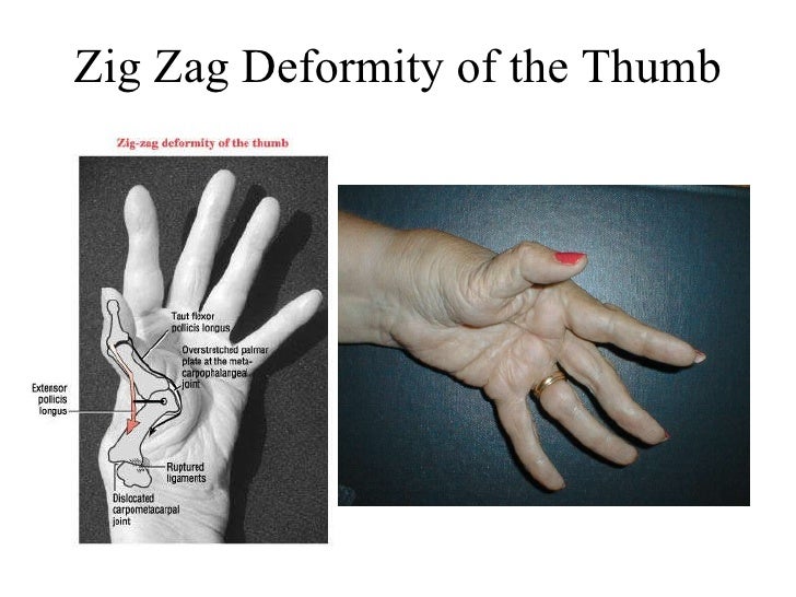 Hand 2009 (2) Questions Included Not To Post