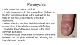 A BRIEF PRESENTION ON HAND AND HAND INFECTIONS | PPTX