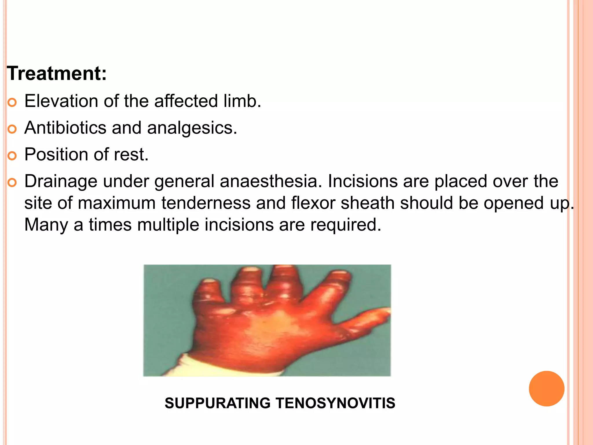 HAND ABSCESS SEMINAR.pptx