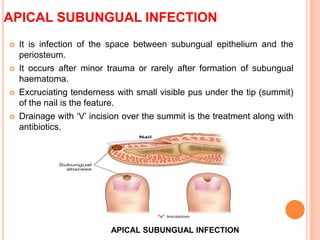 HAND ABSCESS SEMINAR.pptx