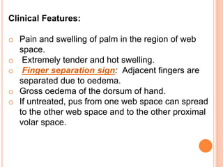 HAND ABSCESS SEMINAR.pptx