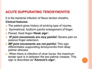 HAND ABSCESS SEMINAR.pptx