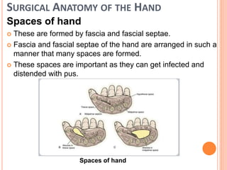 HAND ABSCESS SEMINAR.pptx