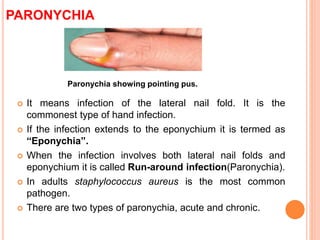 HAND ABSCESS SEMINAR.pptx