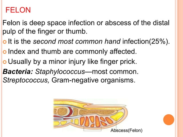 HAND ABSCESS SEMINAR.pptx