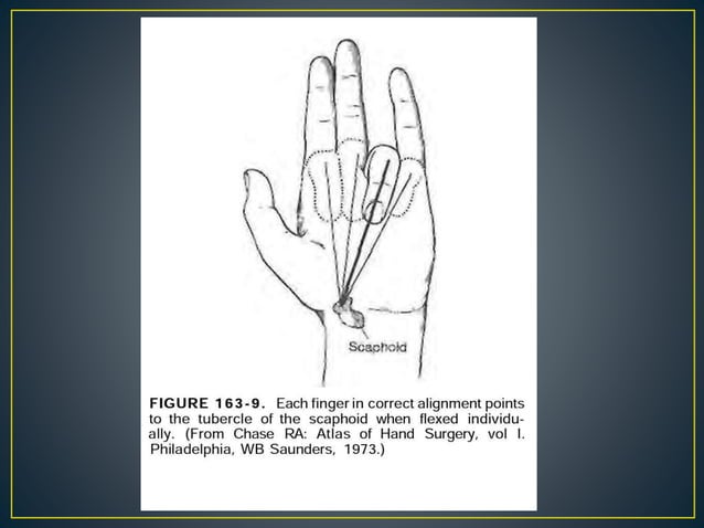 Hand anatomy- harsh amin | PPTX